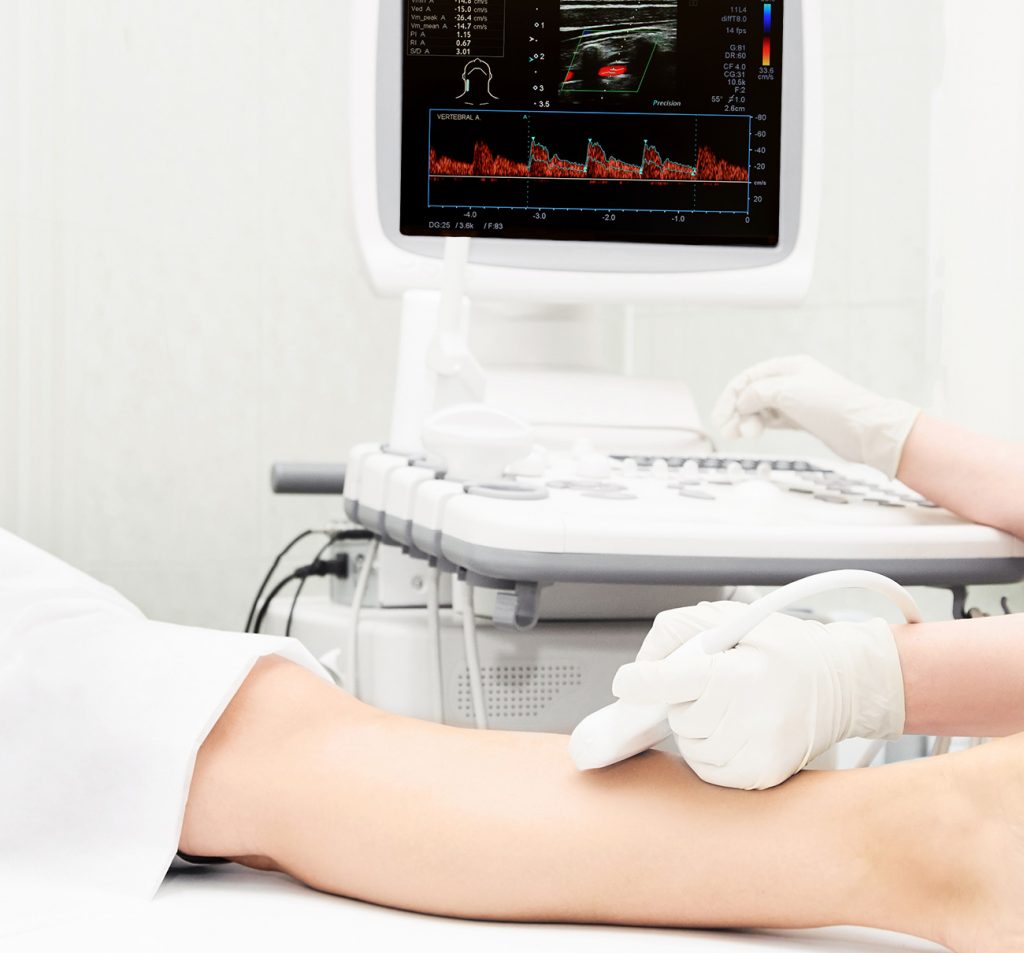 Doppler - Avon Valley Radiology